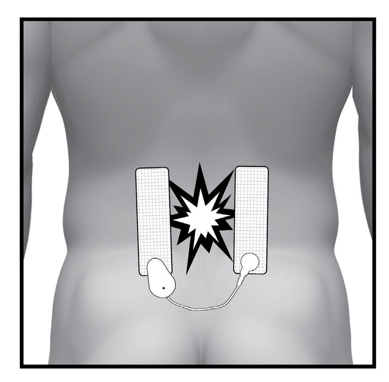 Microlief » Product Information